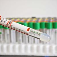 China ORSIN Medical Clot Activator Blood Collection Tube Green Top Blood Tube 100mm for sale