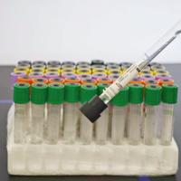 China 7ml 8ml Sodium Citrate ESR Tube With Screw Cap Green Top Lithium Heparin Tube for sale