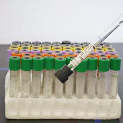 China 7ml 8ml Sodium Citrate ESR Tube With Screw Cap Green Top Lithium Heparin Tube for sale
