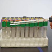China 7ml 8ml Sodium Citrate ESR Tube With Screw Cap Green Top Lithium Heparin Tube for sale