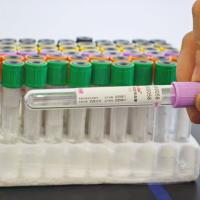 China Purple Cap Cell Protection Vacuum Blood Test Tube CF DNA Blood Test Purple Top for sale