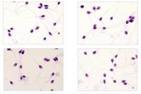 China Ready To Use Diff Quik Stain Kit Differential Quik Stain Kit For Spermatozoa Morphology for sale