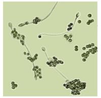 China Kit For Determination of IgA Antibody Coating Spermatozoa (MAR) for sale