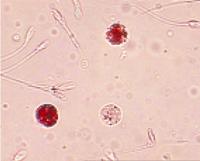 China Simple Operate Men'S Fertility Test Kit Semen Leukocytes Test Kit Peroxidase Staining for sale