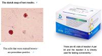 China Semen Leukocytes Test Kit Peroxidase Staining 40T/Kit Sperm Function Test Kit for sale