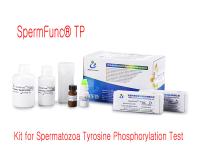 China Professional Sperm Maturity Kit For Determination Protein Tyrosine Phosphorylation for sale