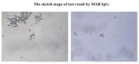 China SpermFunc Male Fertility Test Kit For Determination IgG Antibody Coating Spermatozoa for sale