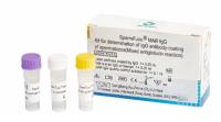 China Anti Sperm Antibody IgG Test Kit MAR AsAb For Immunological Infertility for sale