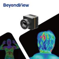 China TEMP317 Uncooled 384x288 17μm Infrared Camera Core for Medical Temperature Screening for sale
