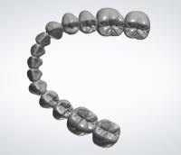 China Restoration EXO Dental Design Service Dental Brace Crown Dental Interior Design for sale