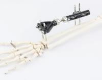 China CE / ISO Orthopedic External Fixator Trauma Sterilized Fracture Distal Radius for sale