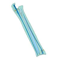 China Titanium Orthopedic Implant Intramedullary Nail System Tibial Approach for sale