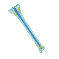 China Tibial Intramedullary Interlocking Nail Titanium Orthopedic Implant for sale