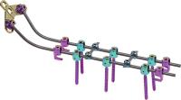 China Spinal Rod System U Multi Axial Pedicle Screw Break Off for sale