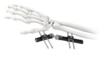 China Orthopedic Wrist External Fixator Standard Single sided Integrated for sale