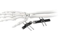 China Orthopedic Wrist External Fixator Standard Single sided Integrated for sale
