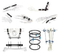 China Hand Bone Pin Stent Radius Mini External Fixator Ortho Combined Type for sale