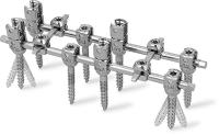 China 5.5 6.0 Double Thread Mono Spine Pedicle Screw For Scoliosis Kyphosis for sale