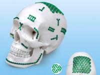 China 48.7mm*13mm Plate Orthopedic Maxillofacial Plating System DF Shaped for sale