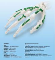 China 120 Degree Metacarpal Plate Titanium Bone Implants OEM ODM for sale
