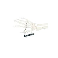 China Factory Price Mini Fragment Orthopedic Orthofix External Fixator With Pins For Finger for sale