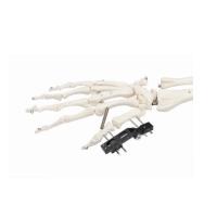 China Factory Price Mini Fragment Orthopedic Orthofix External Fixator With Pins For Finger for sale
