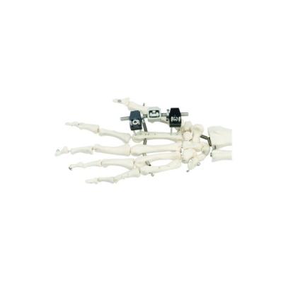 China Factory Price Mini Fragment Orthopedic Orthofix External Fixator With Pins For Finger for sale