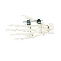 China Factory Price Mini Fragment Orthopedic Orthofix External Fixator With Pins For Finger for sale