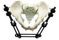 China Surgical Orthopedic External Fixator T Type For Pelvic Fractures for sale