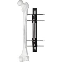 China Pediatric LRS system orthofix Limb Lengthening External Fixator for sale
