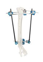 China Gather Hoffmann 2 External Fixation Rods For Pelvic Fractures for sale