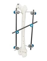 China Hoffmann Ii Orthopedic External Fixator Straight Rod For Tibia Femur Fractures for sale