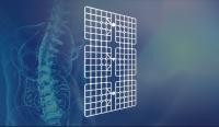 China Percutaneous Curved Kyphoplasty System Positioning Plate Simple Technique for sale