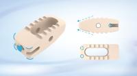 China Spinal Alignment Lumbar Interbody Fusion Cage Lumbar Spinal Cage for sale