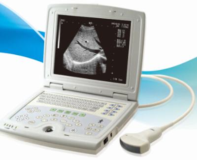 China KX5000 laptop Full digital B mode ultrasonic diagnostic instruments for sale