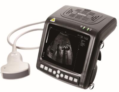 China KX5200 wrist human ultrasound scanner for sale