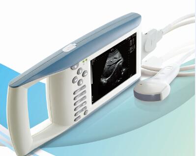 China KX5100 portable human ultrasound scanner for sale