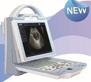 China KX5600 full digital B mode  ultrasound scanner for sale