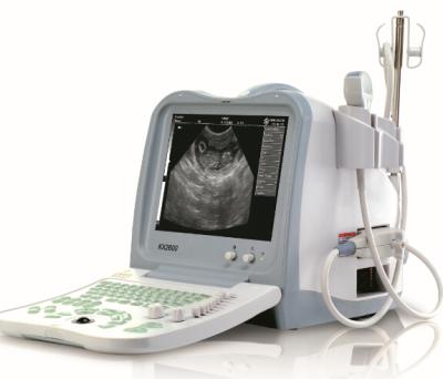 China KX2600V portable  veterinary ultrasound scanner for sale