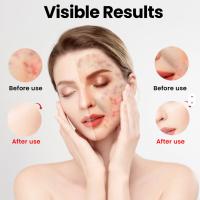 China HSY-FM0208 Portable 4 Colors Silicone Red Light Therapy Facial Masks for sale