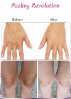 China High-Quality Skin Peeling Serum Promotes Collagen Regeneration and Lifts The Skin for sale