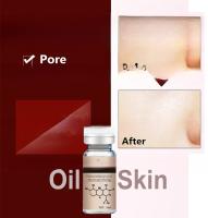 China Meso Skin Care No Needle Mesotherapy Solution Oily Skin Meso Micro-Needling Serum Customized Private Label OEM Factory Price for sale