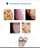 China Customized Skin Care Hyaluronic Acid Mesotherapy Serum with Micro-Needling Technology for sale
