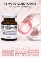 China OEM Private Label Meso Luxury Injectable Mesotherapy Serum Acne Scar Removal Skin Whitening Moisturizing Serum for sale