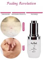 China Grade Professional Grade Acid Peeling Material Skin Exfoliating Serum 15% 25% 35% for sale
