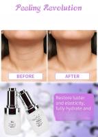 China Odm Skin Peeling Oil Serum Exfoliator For Removing Dead Skin Cells for sale