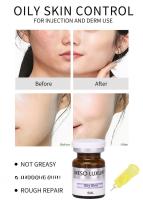 China Youth Serum Injection 5ml Anti-Aging Whitening Nourishing Mesotherapy Filler for Oily Skin Injectable Serum for sale