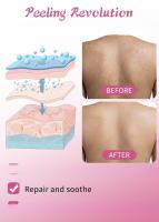 China Facial Deep Cleansing Skin Peeling Serum Oil Whitening Exfoliate Liquid 30ml for sale