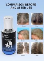 China Hair Growth Serum Mesotherapy with Biotin Olive Fruit Extract OEM Private Label Stalidearm for sale