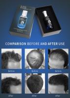 China Prevent Thinning Hair with Advanced Hair Growth Serum and Customized Hair Mesotherapy for sale